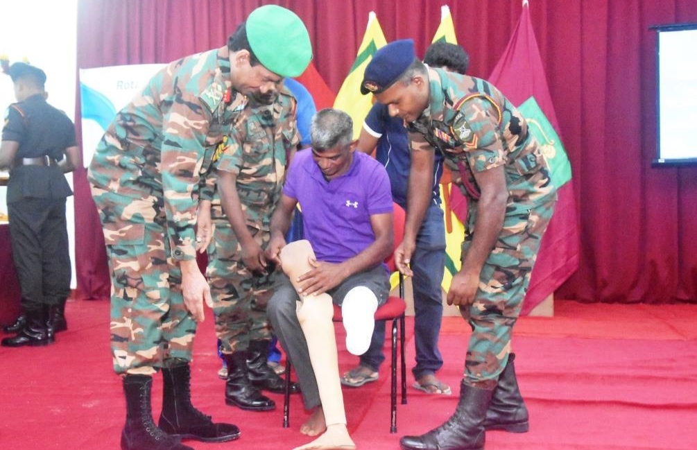 Prosthetic legs and spectacles provision Program - Ceylon Daily News